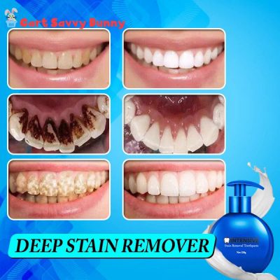 INTENSIVE STAIN REMOVAL TOOTHPASTE - 75% Off - Wizzgoo