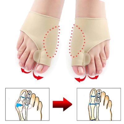 Foot Toe Correction Brace - Buy Online 75% Off - Wizzgoo Store