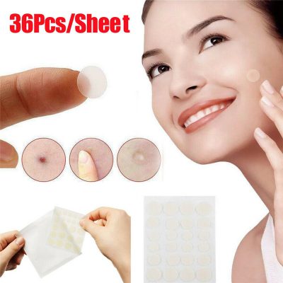 36pcs Skin Tag Remover Patch - Buy Online 75% Off - Wizzgoo Store