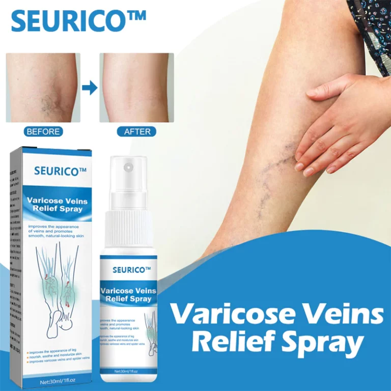Seurico™ Vein Varicose Relief Spray - Wizzgoo Shop