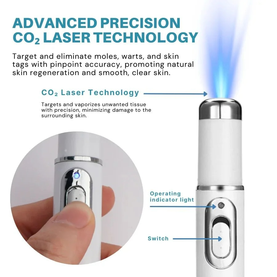 Powerful Laser Pen for Easy Mole & Wart Removal - DermaZap™